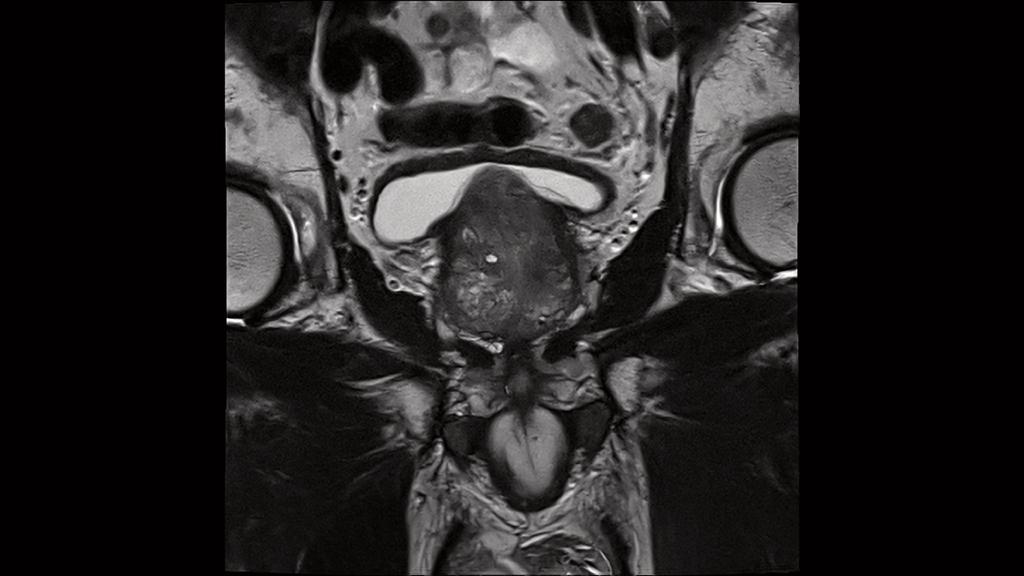 MAGNETOM Cima.X - Make the difference. - Siemens Healthineers