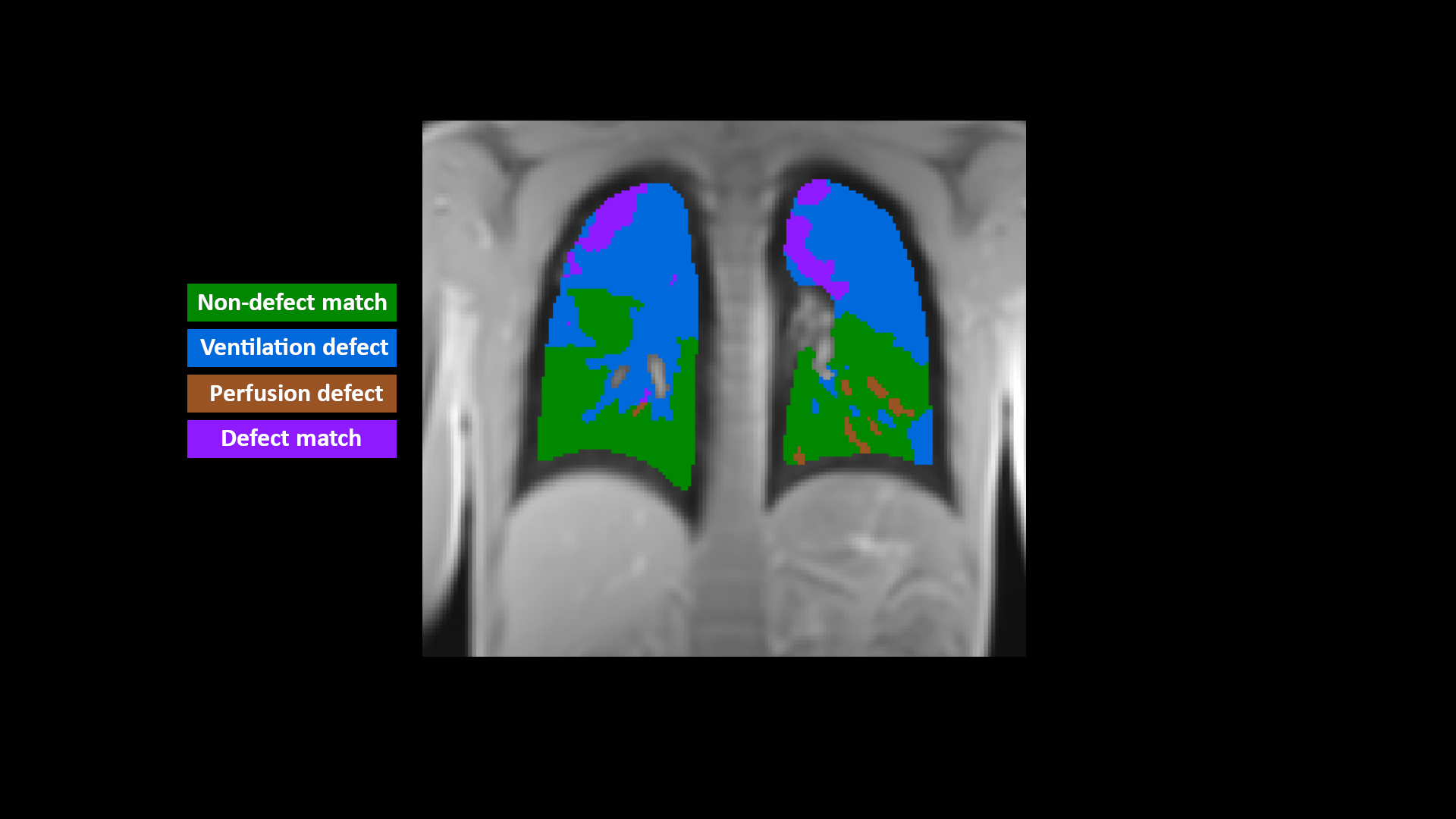 LungMaps