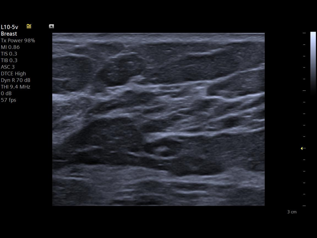 ACUSON Maple is a High-Performance Shared Service Ultrasound System ...