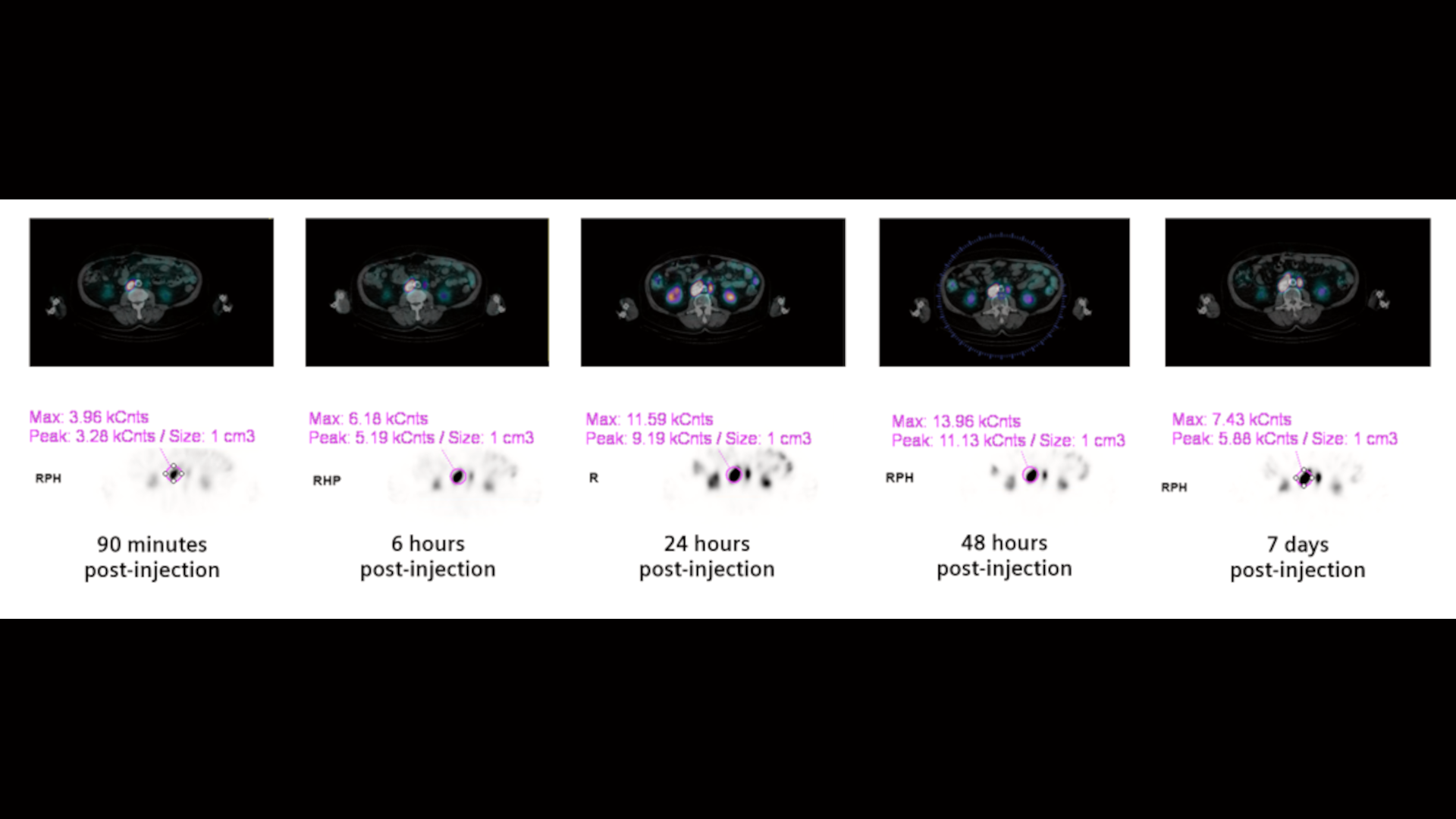 Tumor and organ dosimetry from sequential quantitative SPECT/CT