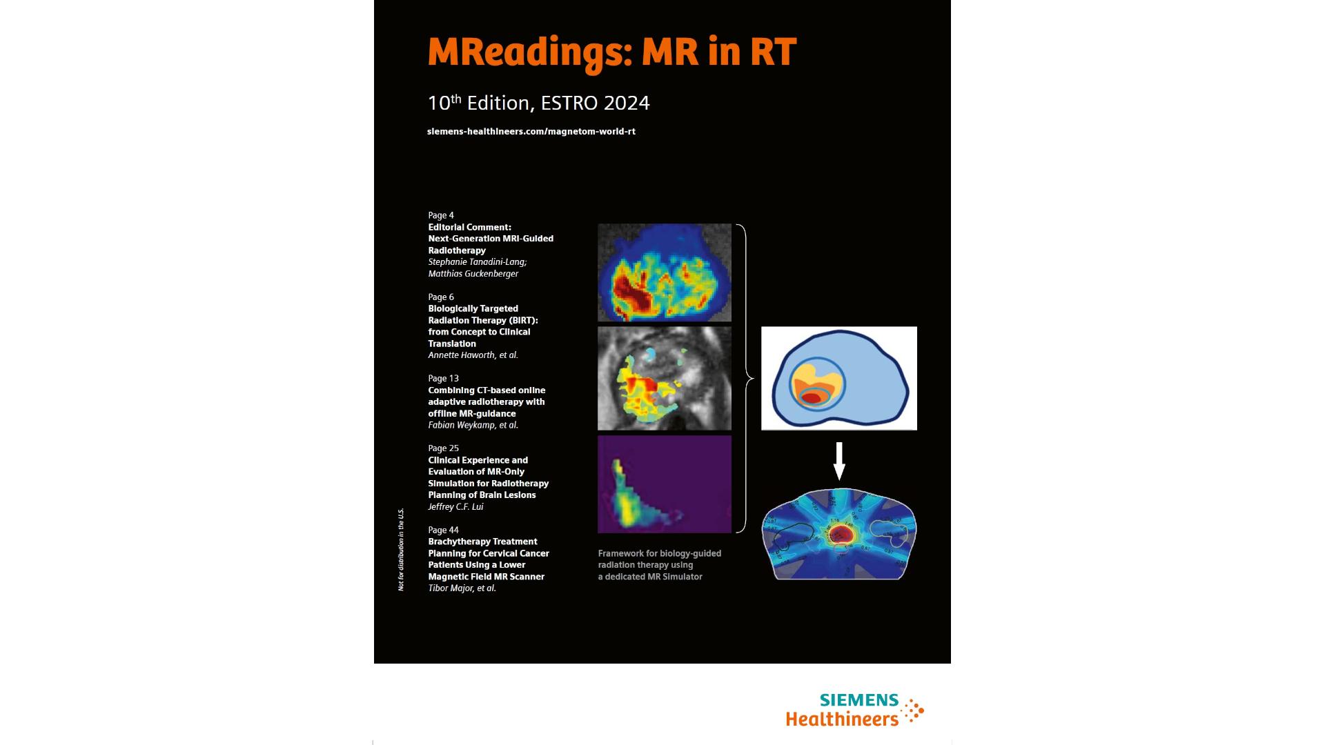 MRI for radiation therapy - Siemens Healthineers
