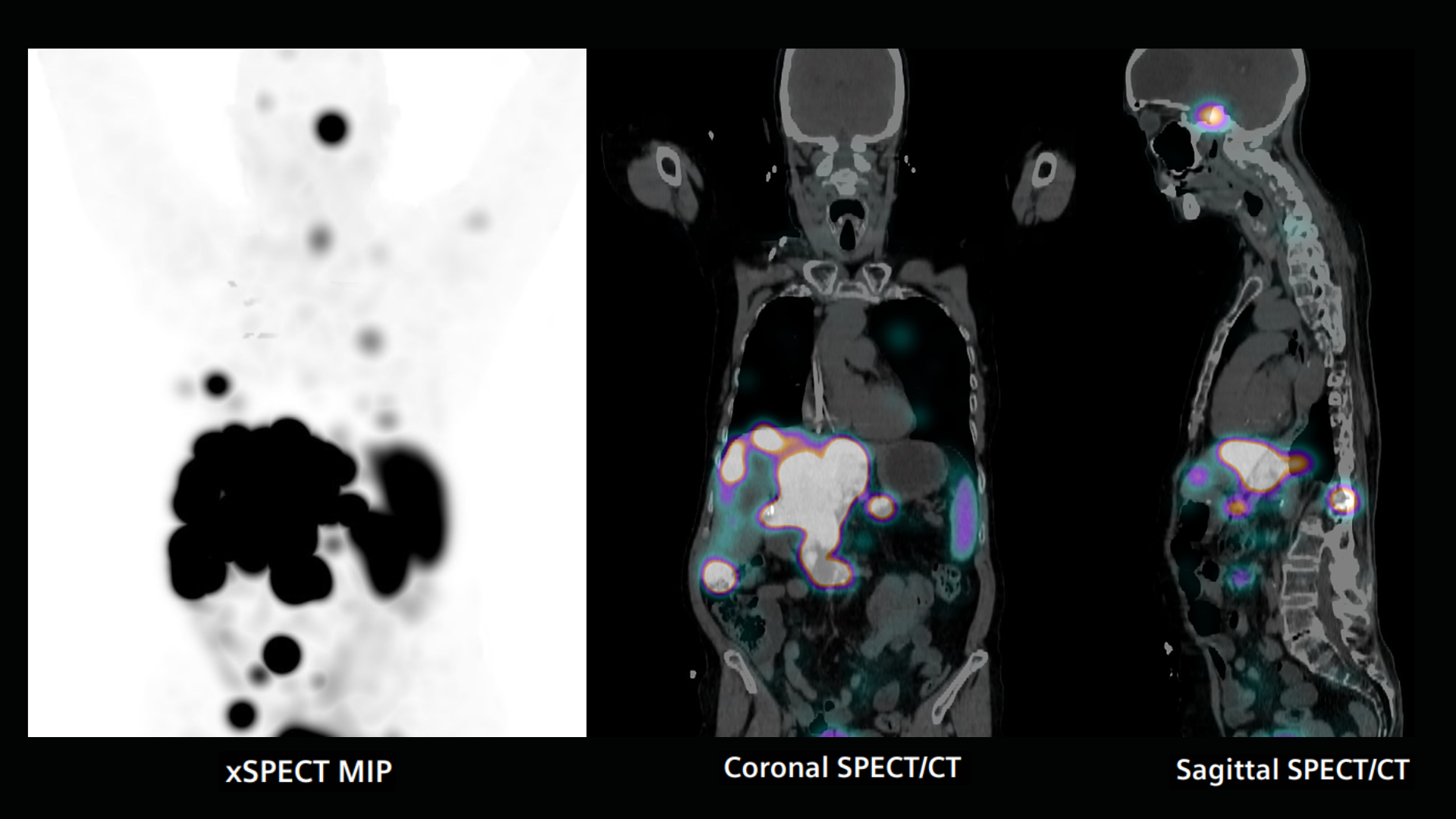 Theranostics center of excellence: transforming oncology care - Siemens ...
