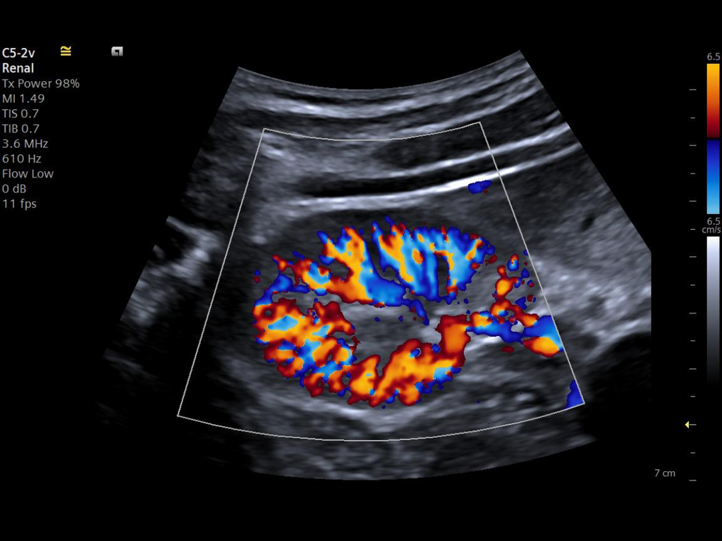 ACUSON Maple is a High-Performance Shared Service Ultrasound System ...