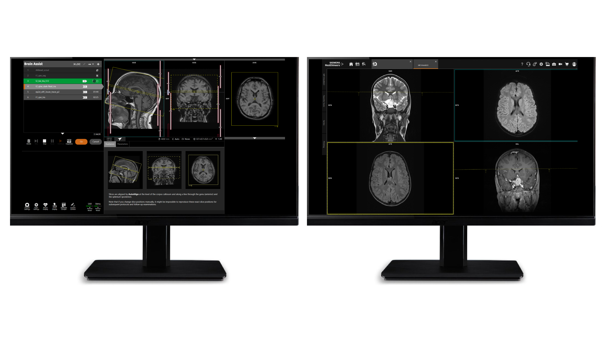 Meet the family of Fit Upgrade with BioMatrix technology - Siemens ...