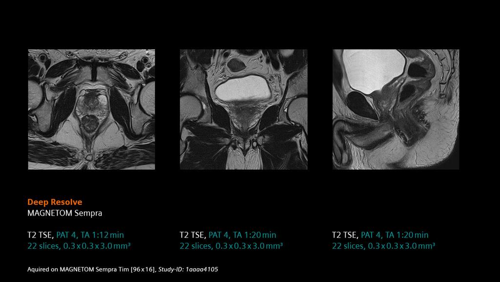 Deep Resolve - Siemens Healthineers