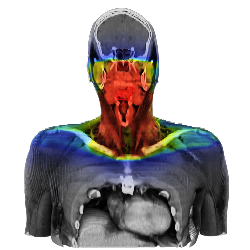 Computed Tomography simulation - Siemens Healthineers - Siemens Healthineers
