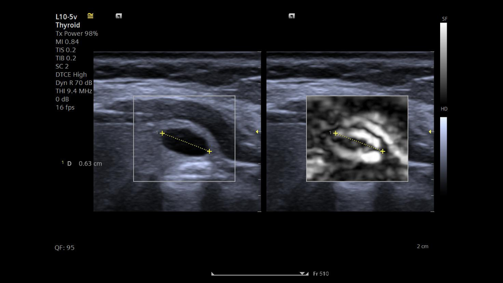 ACUSON Maple is a High-Performance Shared Service Ultrasound System ...