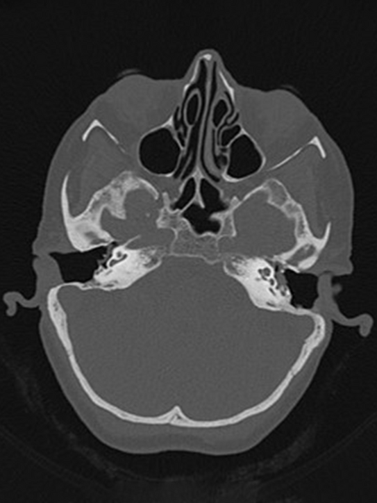 SOMATOM Pro.Pulse Dual Source CT scanner - Siemens Healthineers USA