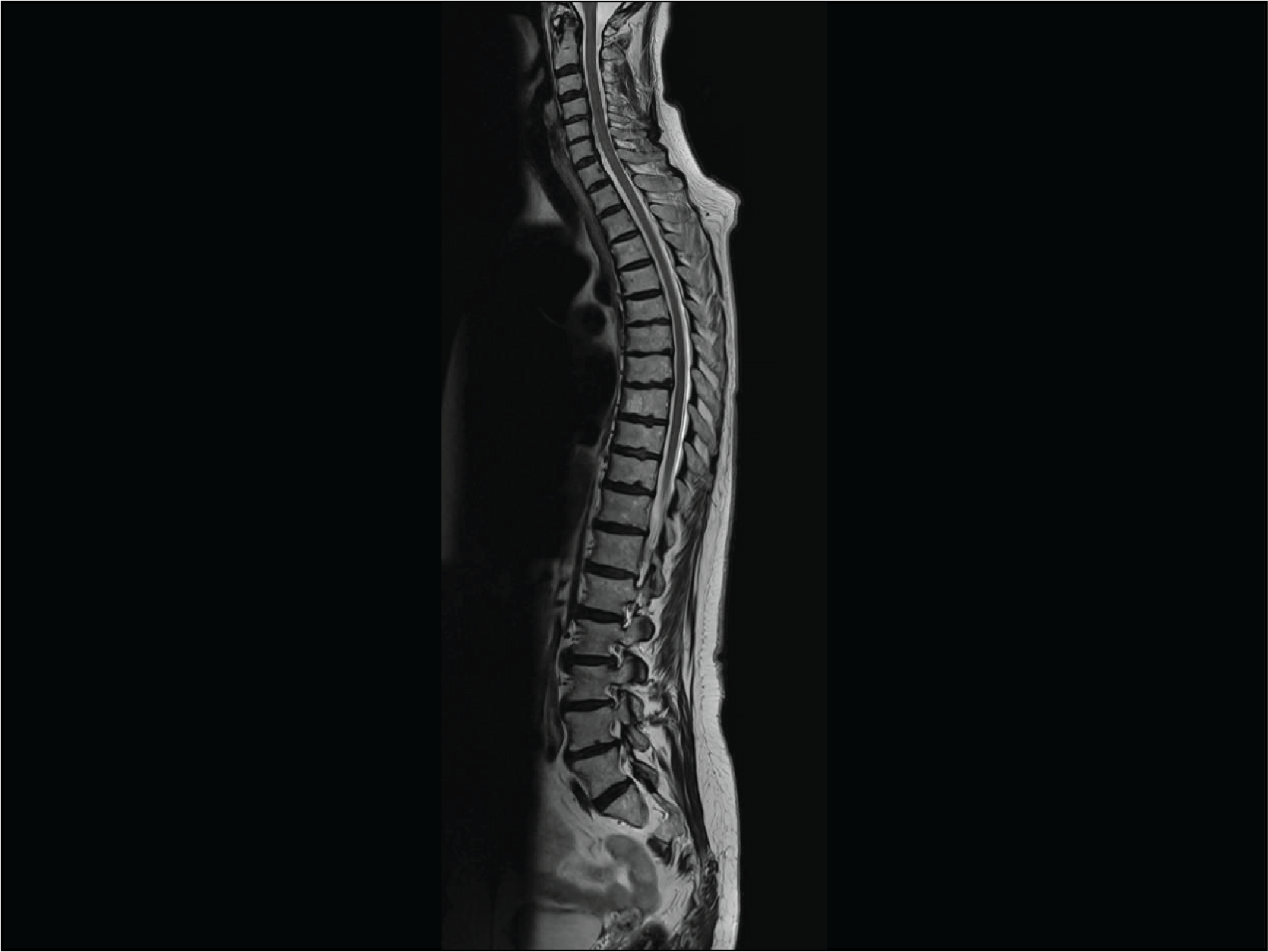 Siemens Healthineers introduces MAGNETOM Flow for greater ...