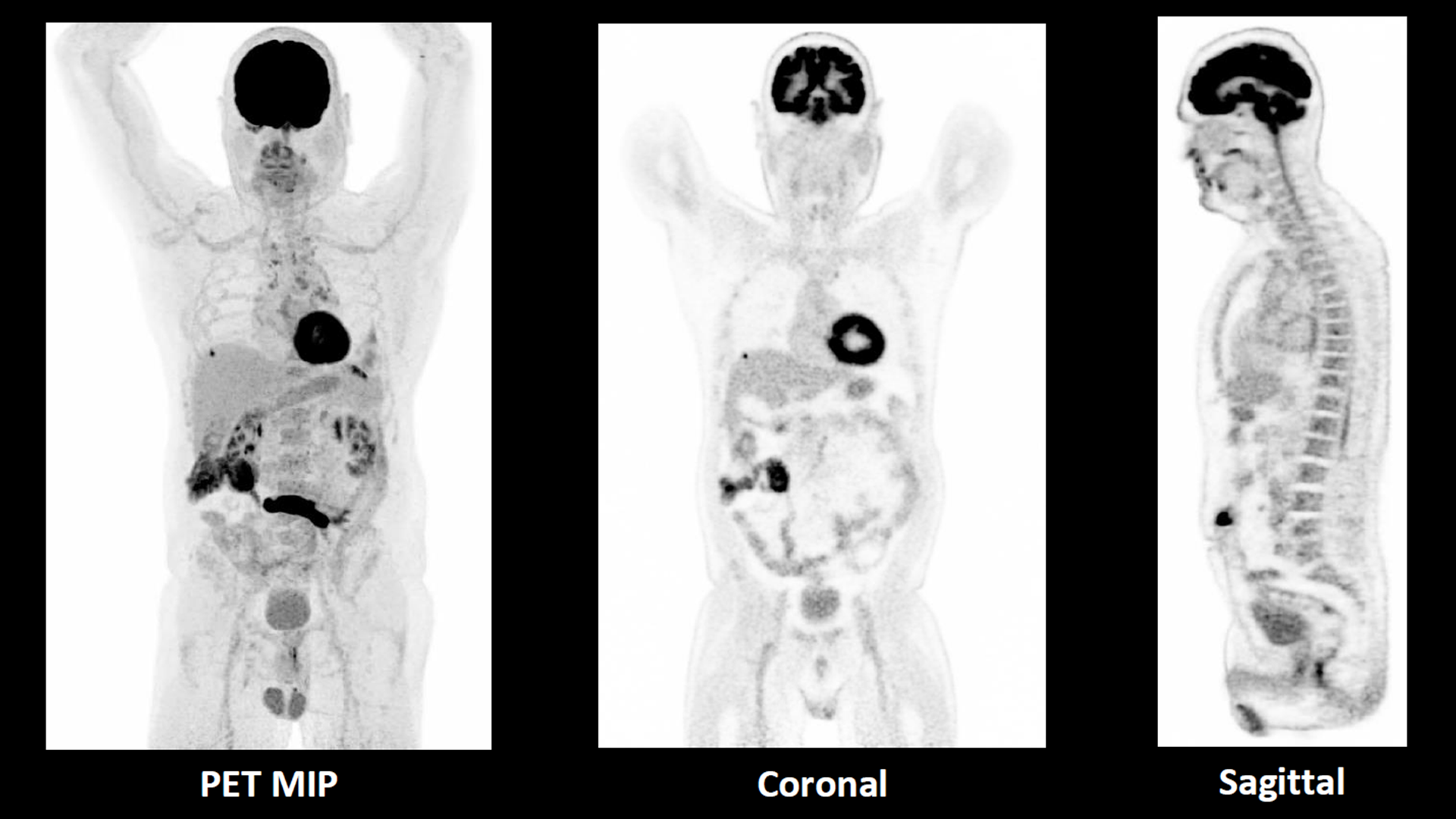 Biograph Vision PET/CT Scanner - Siemens Healthineers