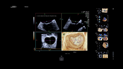 ACUSON Origin Cardiovascular Ultrasound System - Siemens Healthineers USA