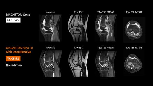 Pediatric MRI - Siemens Healthineers