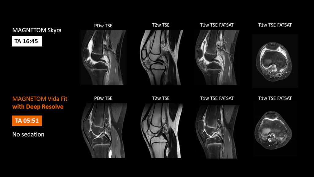 Pediatric MRI - Siemens Healthineers