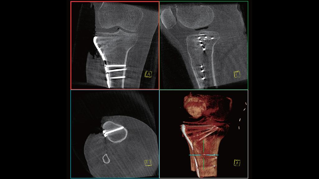 Mobile C-arm machine - Cios Spin - Siemens Healthineers Japan