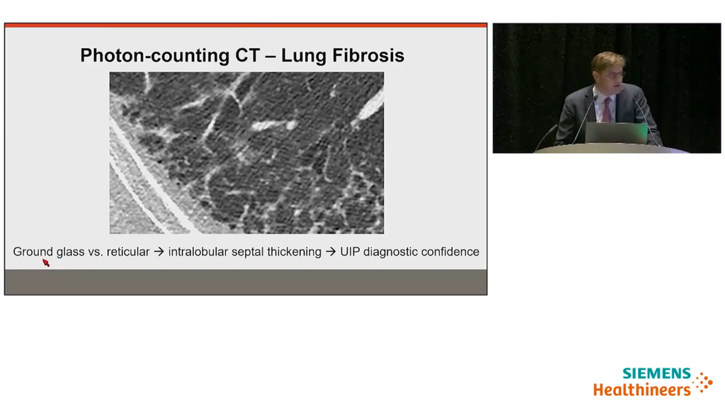 Computed Tomography Scientific Presentations - Siemens Healthineers USA