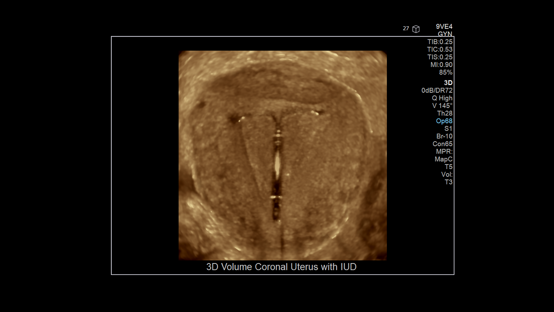 ACUSON Sequoia Ultrasound System - Siemens Healthineers