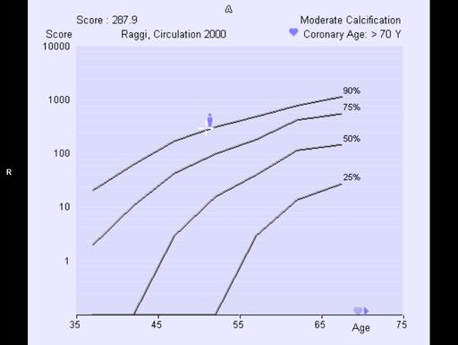 CT calcium scoring: Ultra low dose coronary Ca scoring screening ...