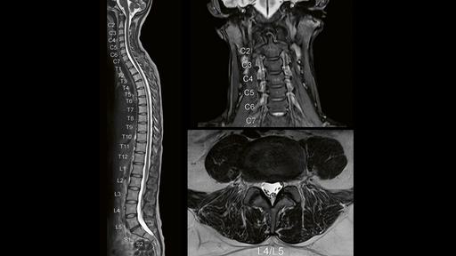BioMatrix Fit Upgrades - Siemens Healthineers