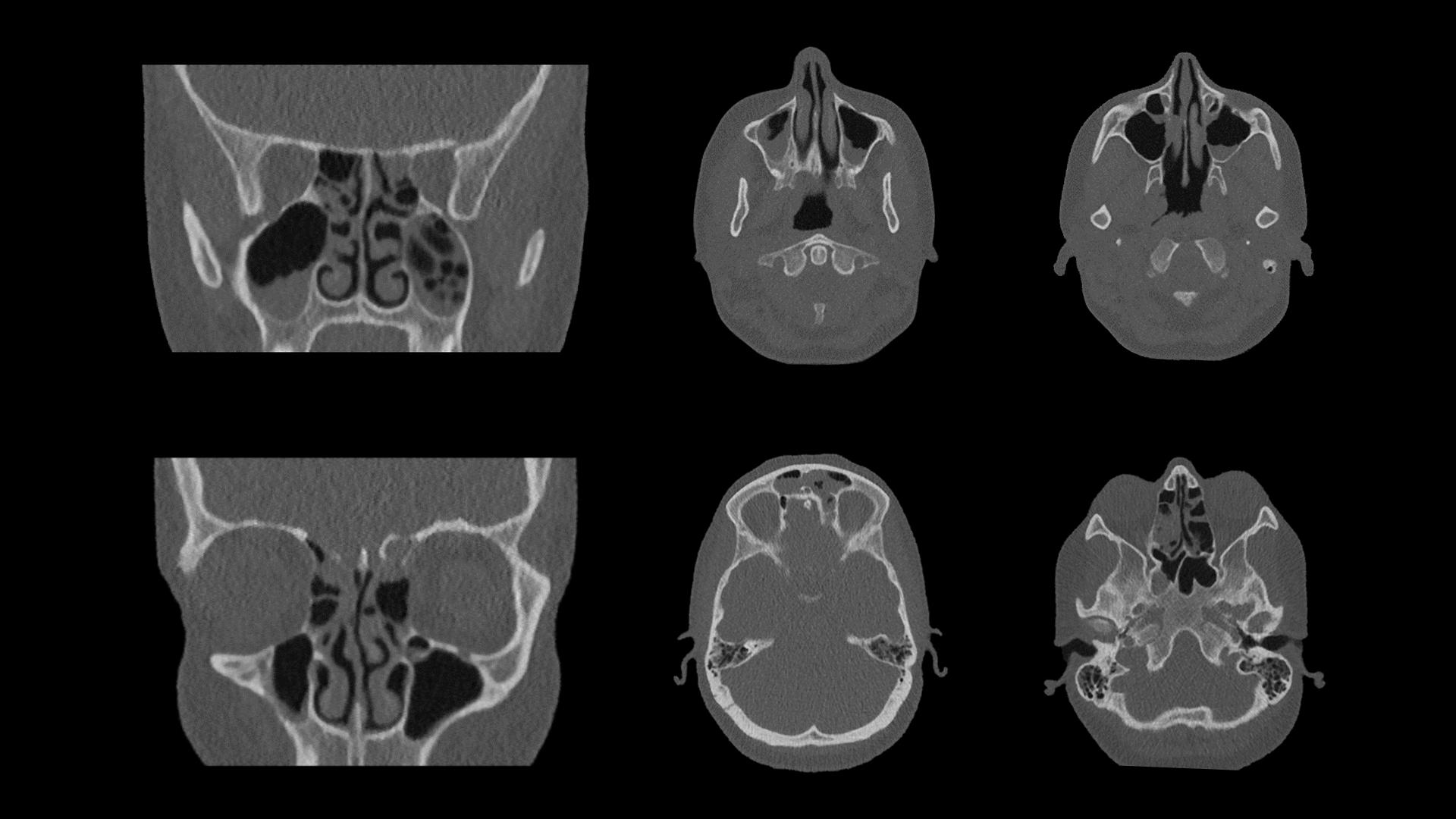 The SOMATOM X. platform – Intelligent imaging - Siemens Healthineers USA