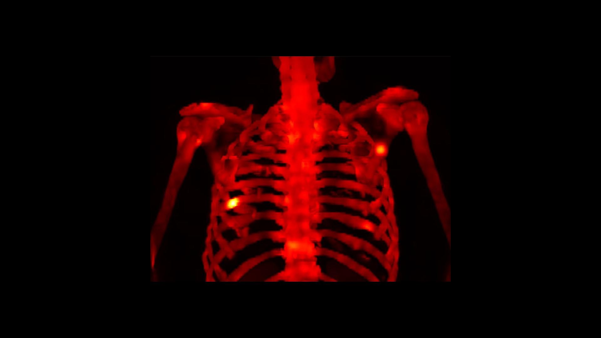 Molecular Imaging - Siemens Healthineers USA