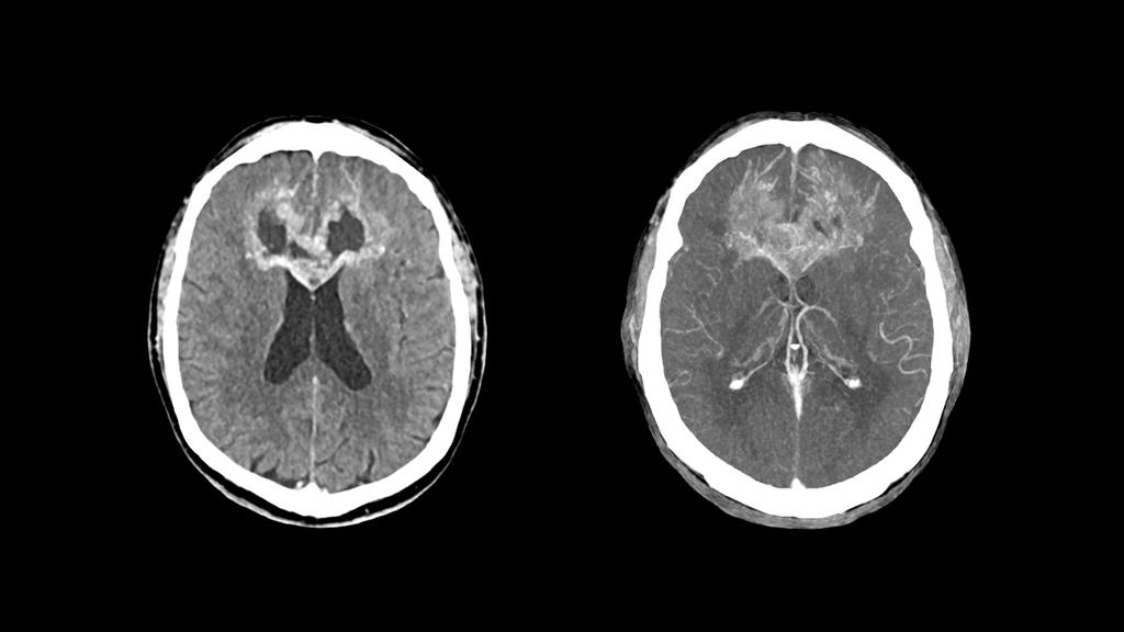 SOMATOM Edge Plus - Siemens Healthineers USA