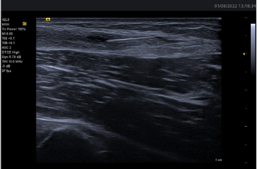 MSK Ultrasound