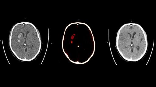Dual Energy CT Spectral Imaging - Siemens Healthineers USA