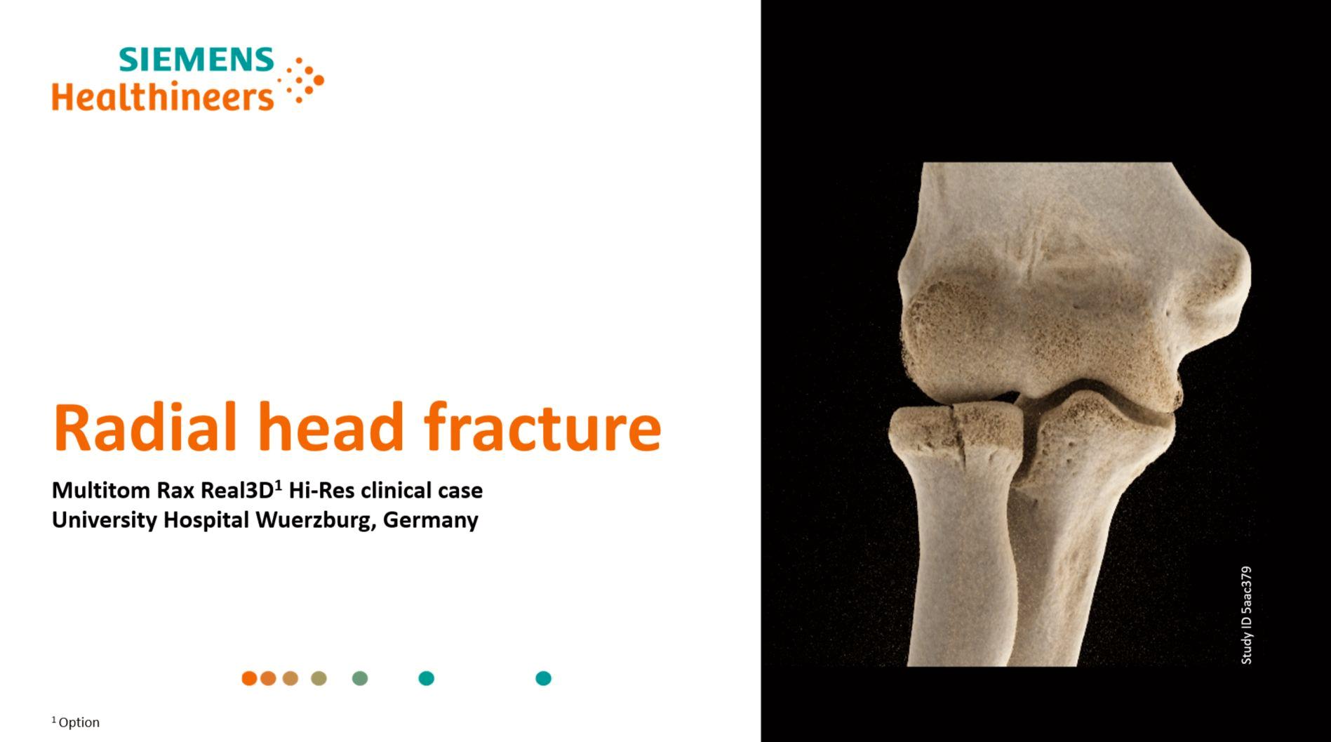 Robotic X-Ray - Clinical Case Library - Siemens Healthineers