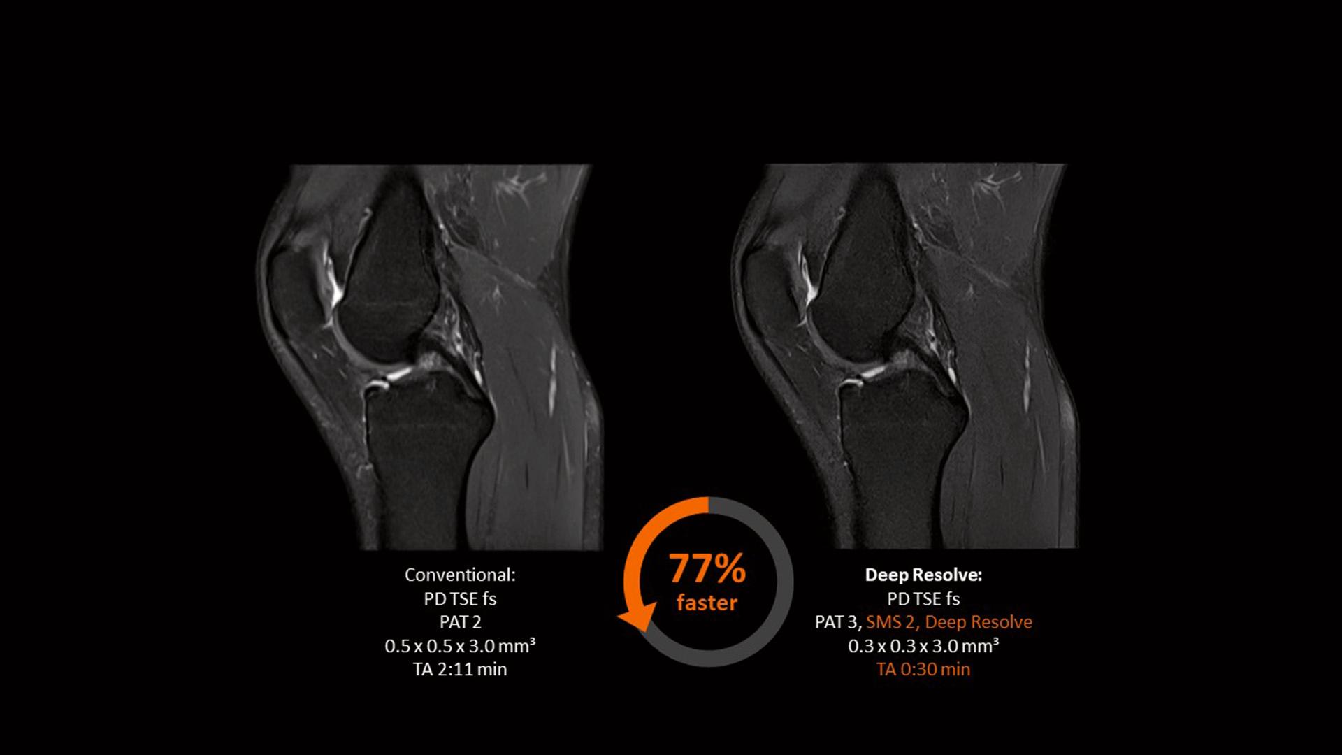 MAGNETOM Viato.Mobile - Siemens Healthineers USA