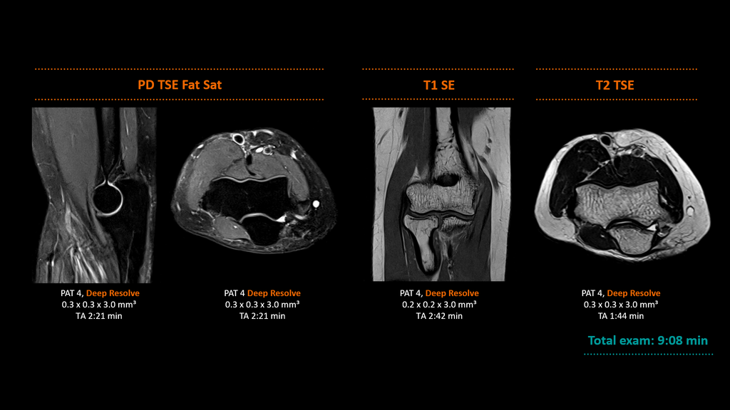 Musculoskeletal Imaging - Siemens Healthineers