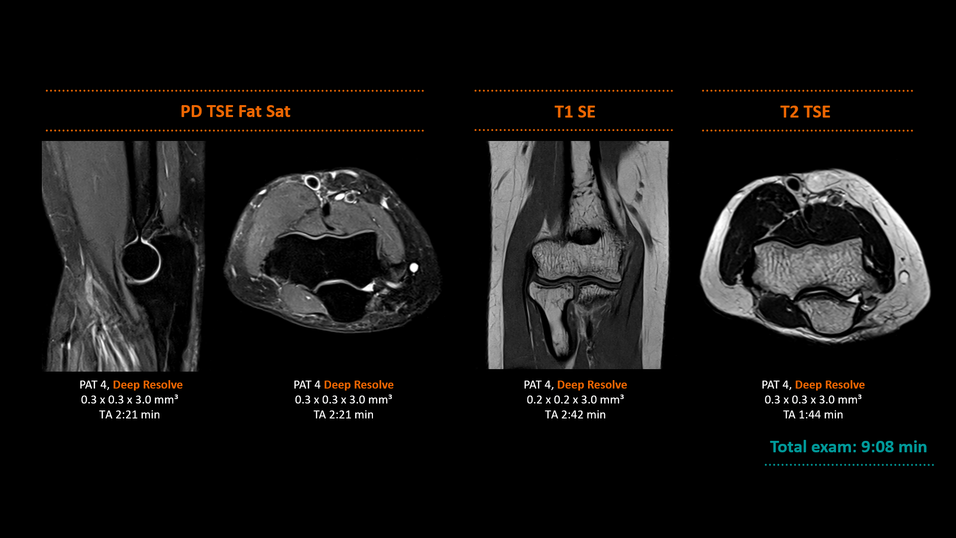 Musculoskeletal Imaging - Siemens Healthineers USA