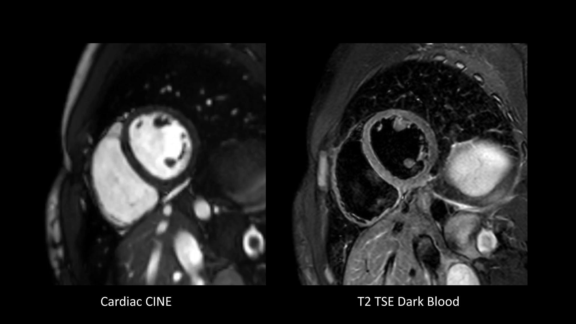 BioMatrix Contour Coils - Siemens Healthineers