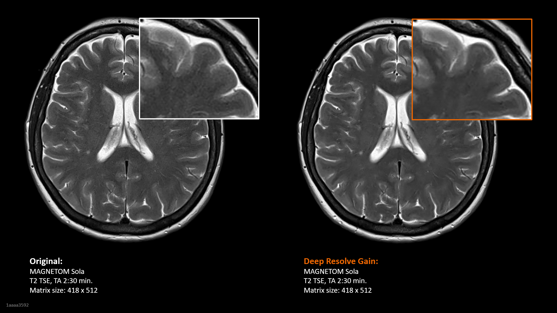 Options & Upgrades - Get the most from your investment - Siemens ...