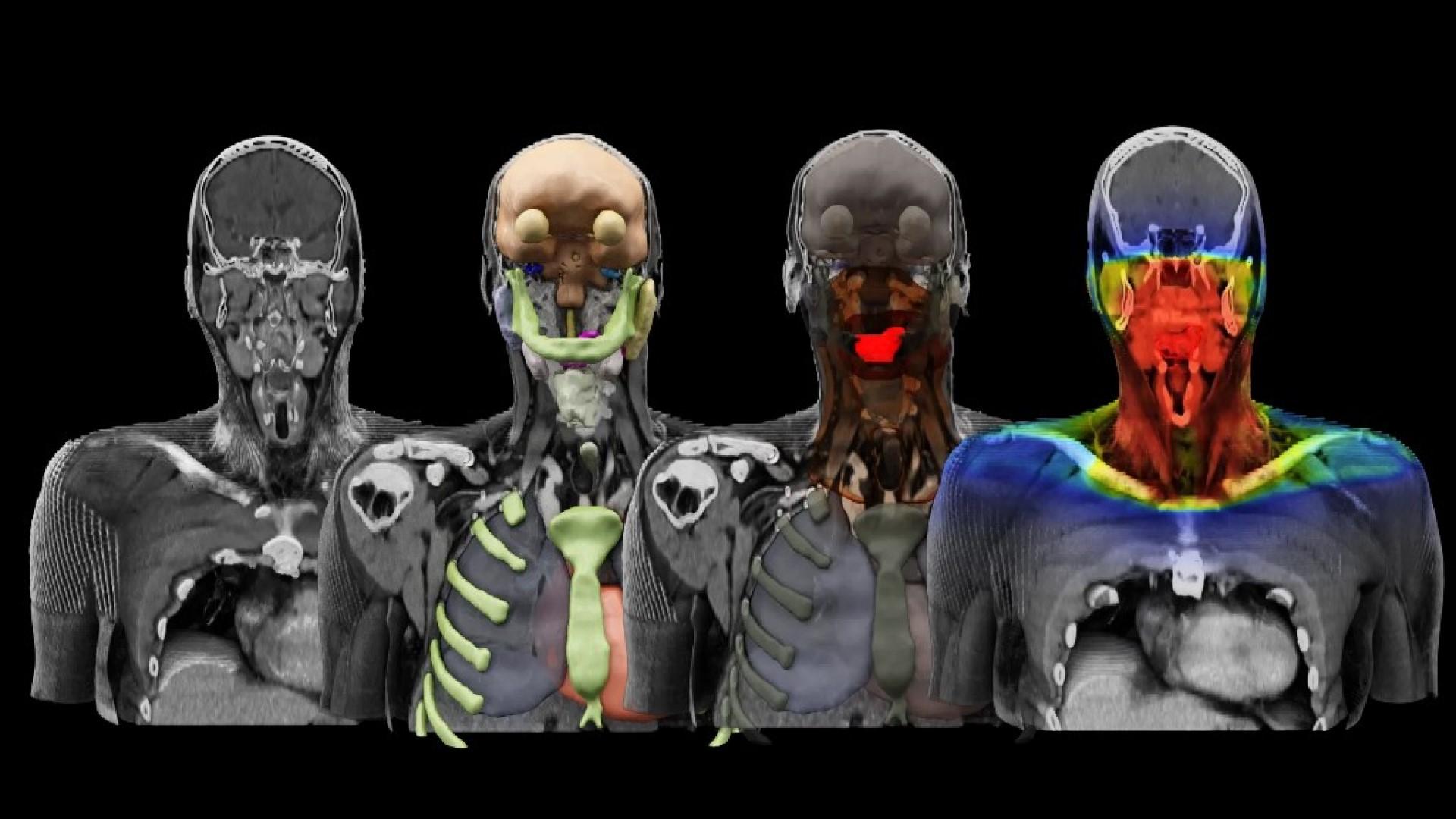 SOMATOM go.Sim - Siemens Healthineers