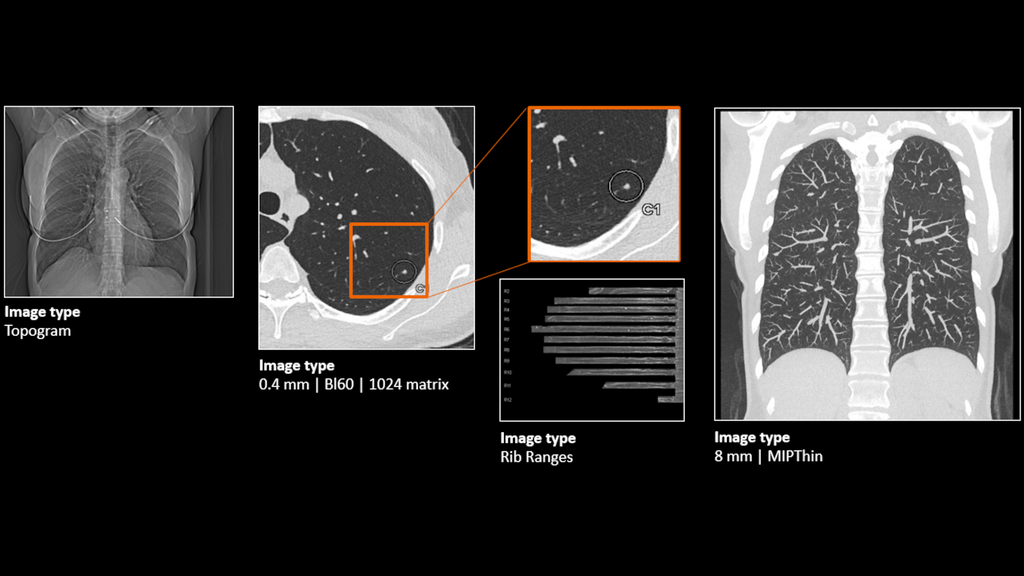 The Siemens Healthineers CT Imaging Chain - Siemens Healthineers