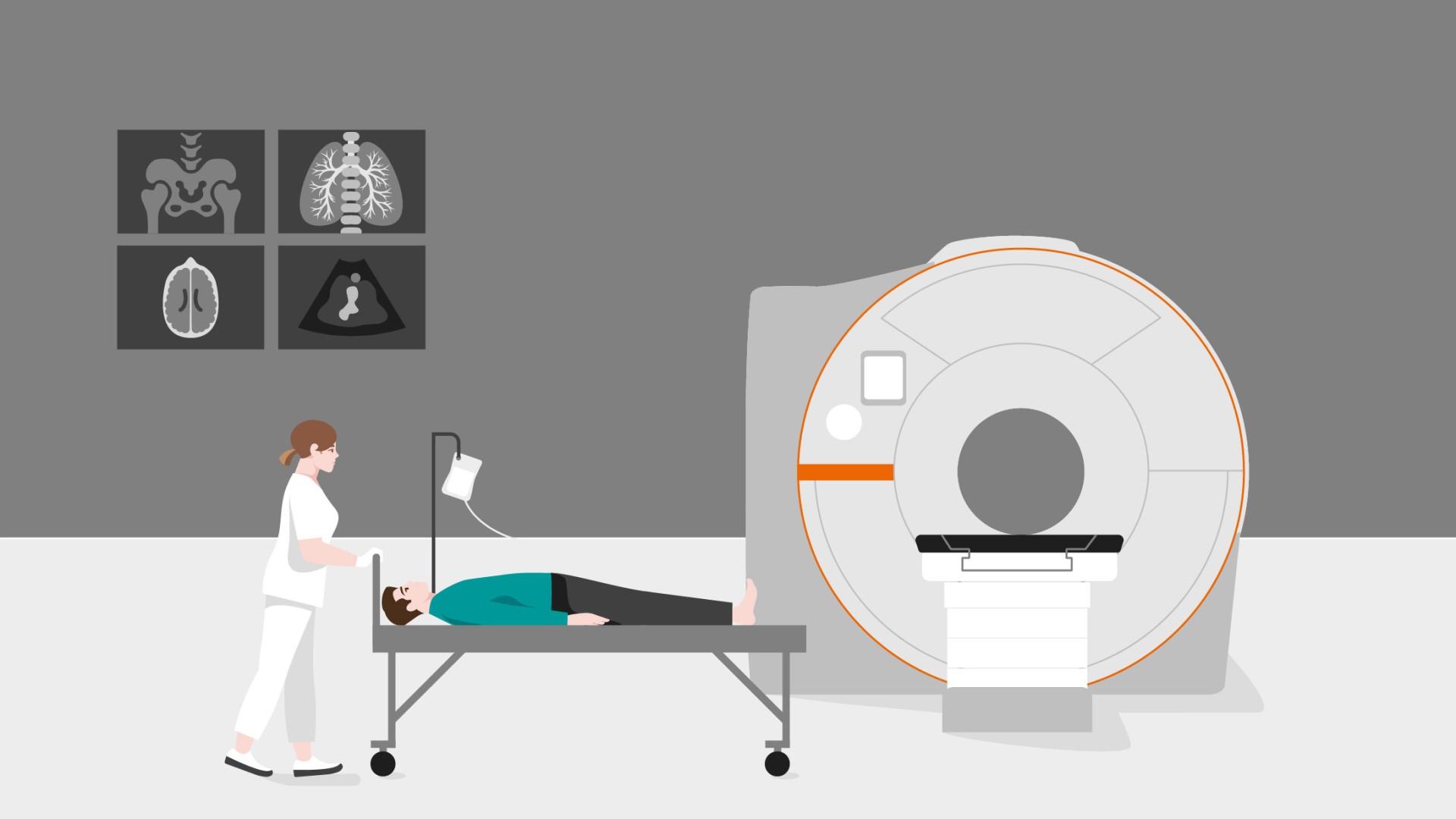 How a dedicated MRI resource can impact radiation therapy - Siemens ...