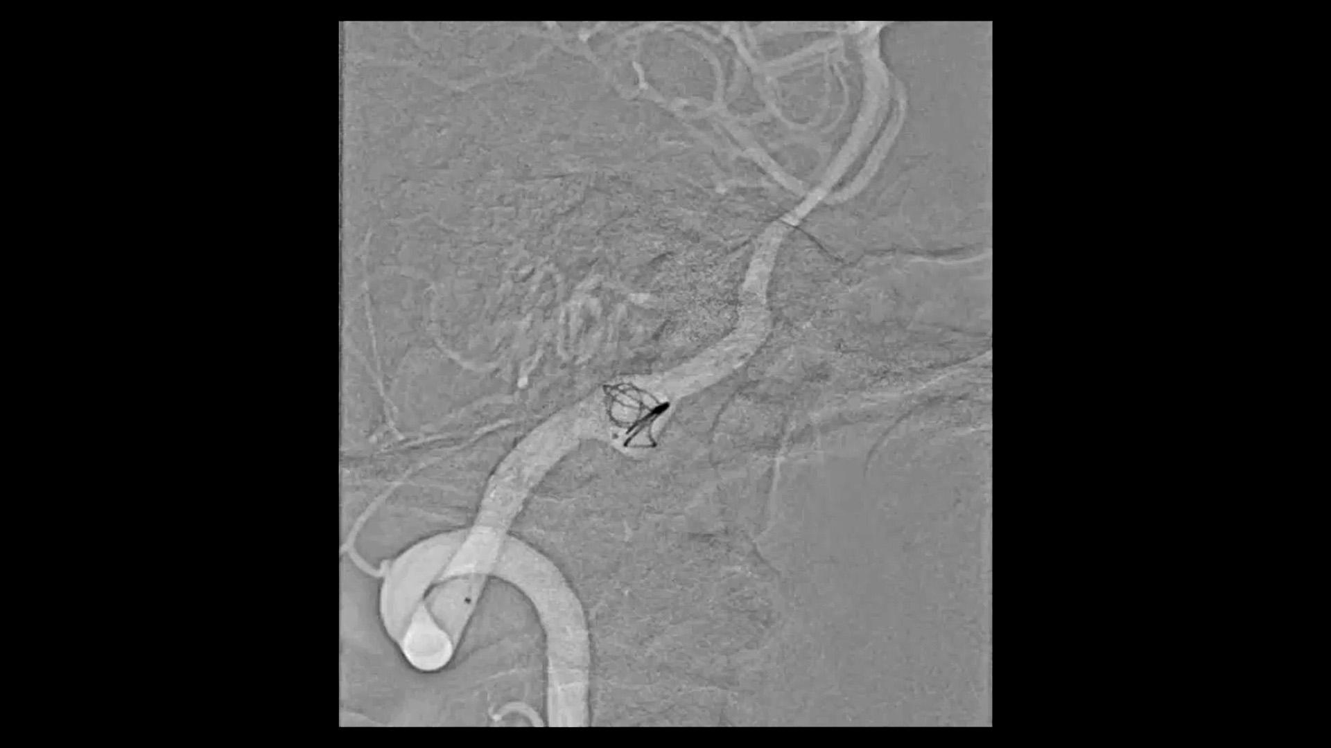 Artis Q - Siemens Healthineers