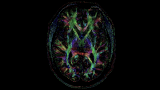MAGNETOM Prisma - MRI Scanner - Siemens Healthineers