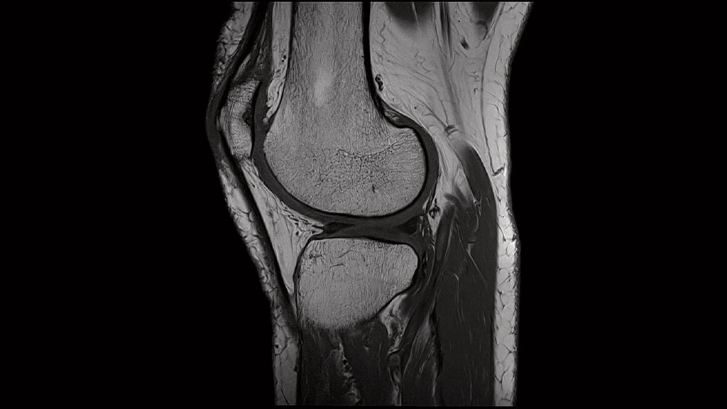 MAGNETOM Cima.X - Make the difference. - Siemens Healthineers