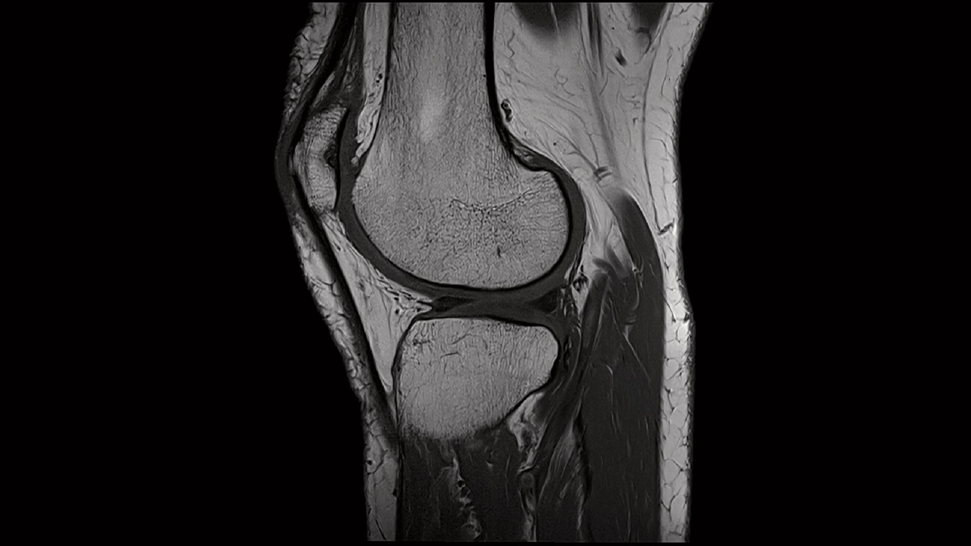 MAGNETOM Cima.X - Make the difference. - Siemens Healthineers