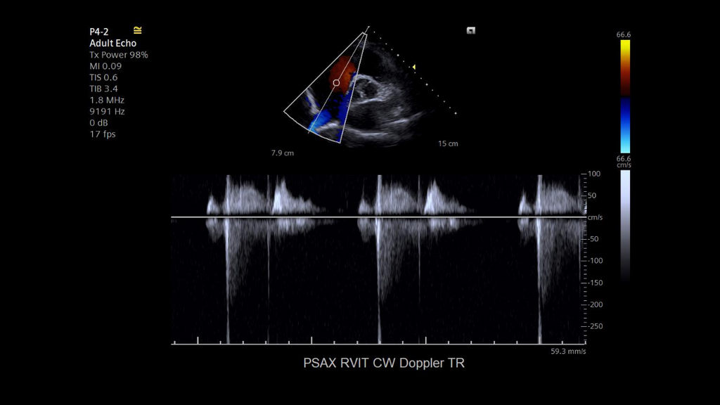 ACUSON Maple is a High-Performance Shared Service Ultrasound System ...