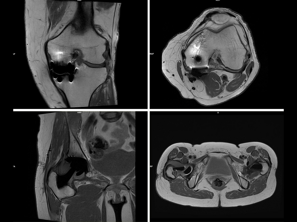 Musculoskeletal MRI