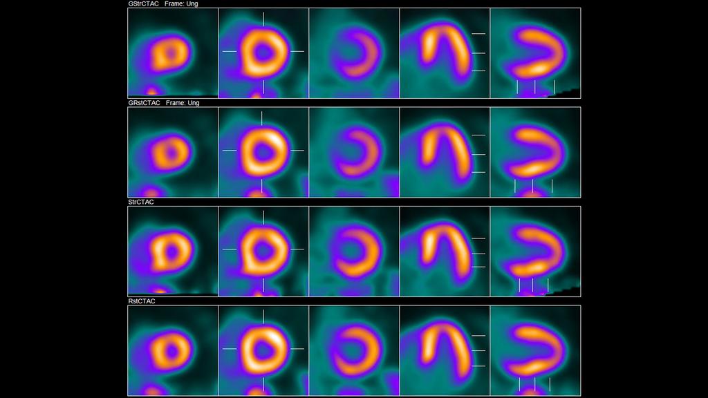 Biograph PET/CT family - Siemens Healthineers