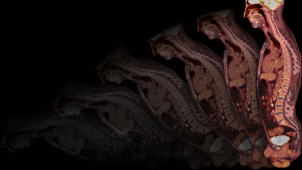 PETNET On Oncology - Siemens Healthineers USA