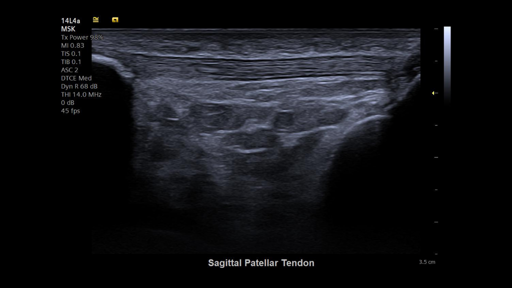 ACUSON Maple is a High-Performance Shared Service Ultrasound System ...