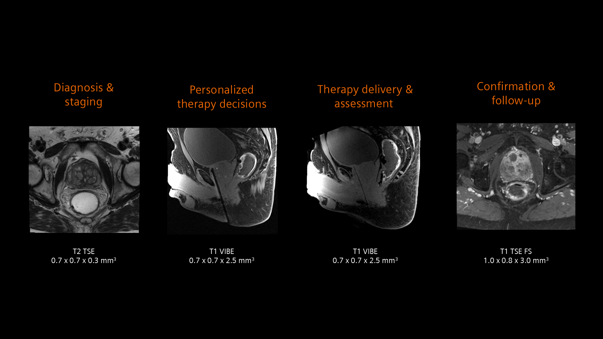 Interventional MRI Suite – Leading the way in iMRI - Siemens Healthineers