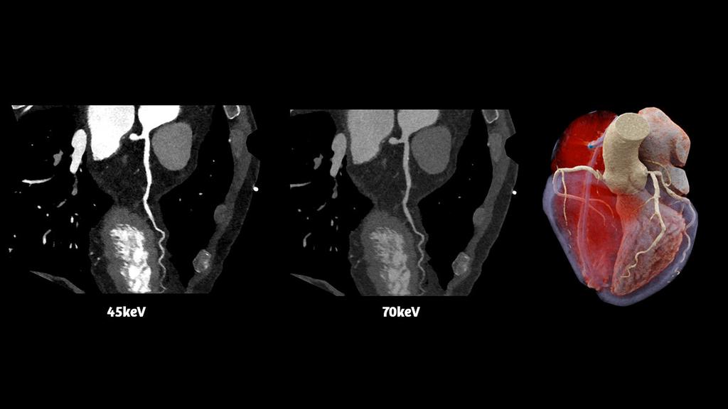 Contrast media - Siemens Healthineers