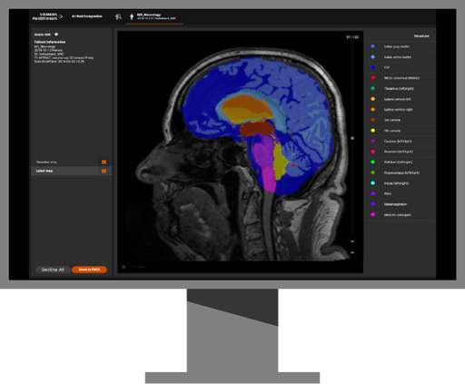 MRI for Alzheimer's disease - Siemens Healthineers USA