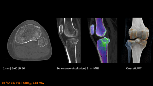 Dual Source CT - Siemens Healthineers