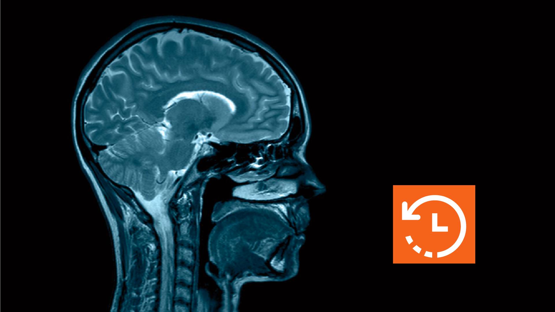 Servicio rápido: un arma potente contra las secuelas del ACV - Siemens ...